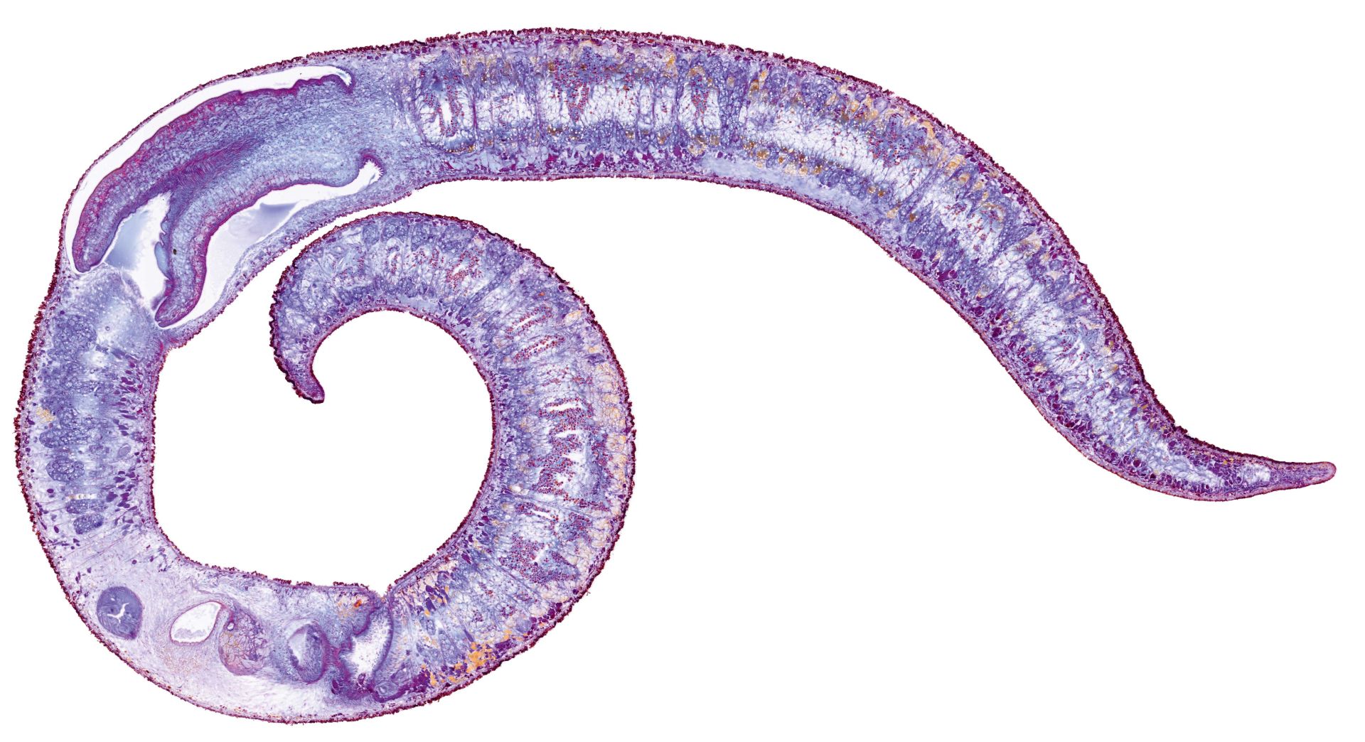 Auf den Wurm gekommen – CampusPost